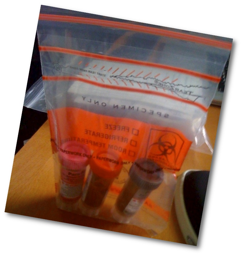 Follow the poop: Stool analysis must to detect food poisoning | barfblog