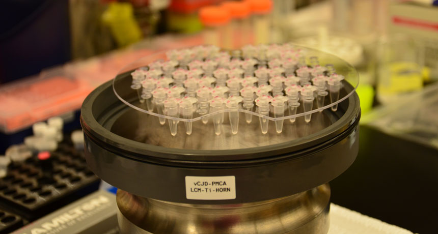 New blood tests can detect prions | barfblog
